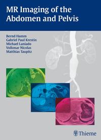 Bernd Hamm - MR Imaging of the Abdomen and Pelvis » Buch