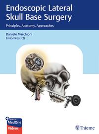 Thieme, Stuttgart - Endoscopic Lateral Skull Base Surgery » Buch